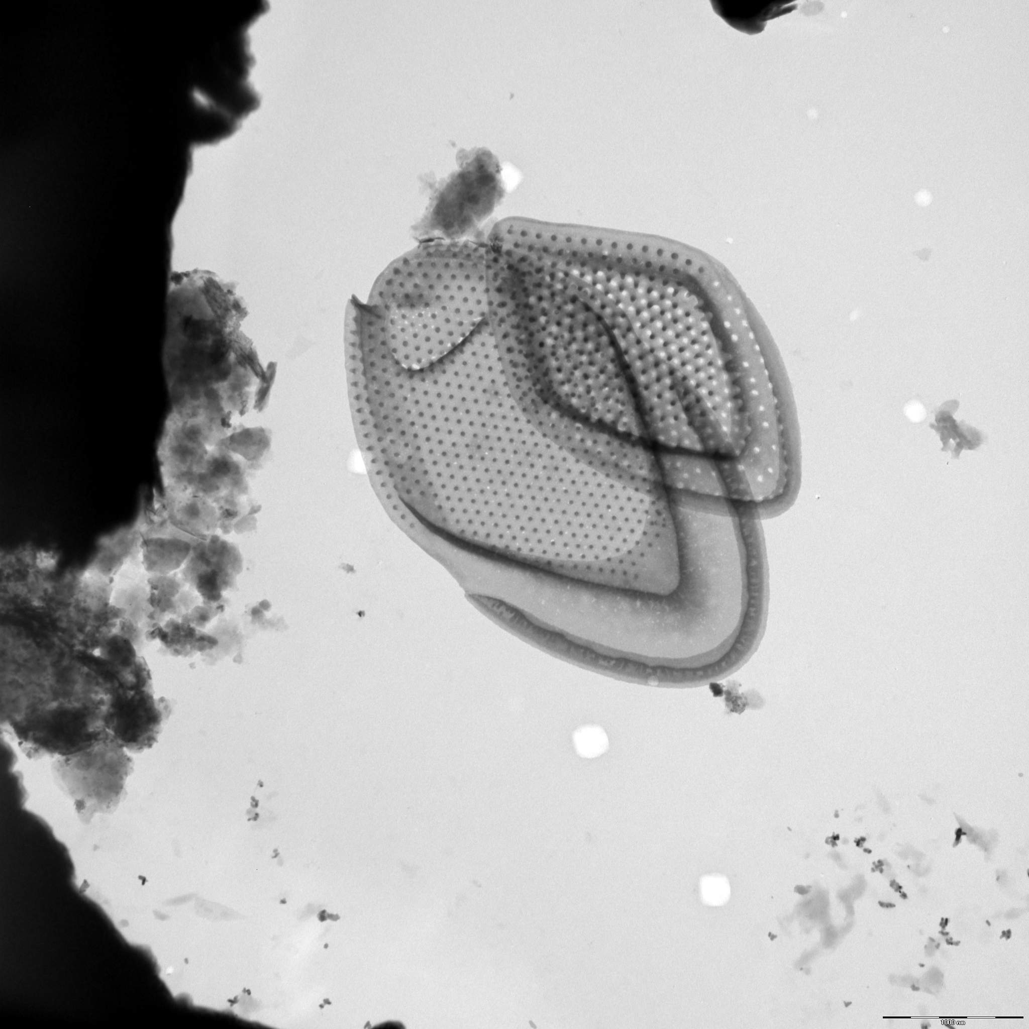 Mallomonas paxillata | Silica-scaled chrysophytes of Europe